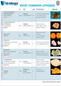 Most common lithiasis - Urology Cheatsheets