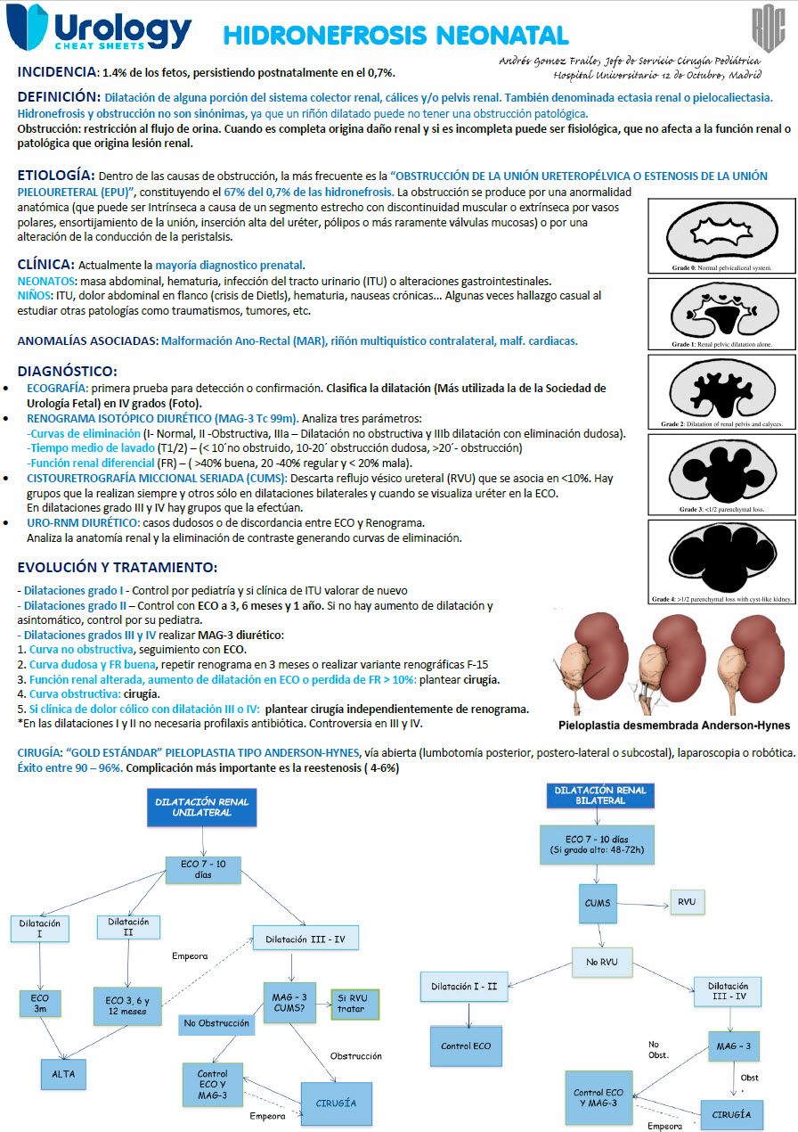 Hidronefrosis Neonatal By Andrés Gómez Fraile - Urology Cheatsheets