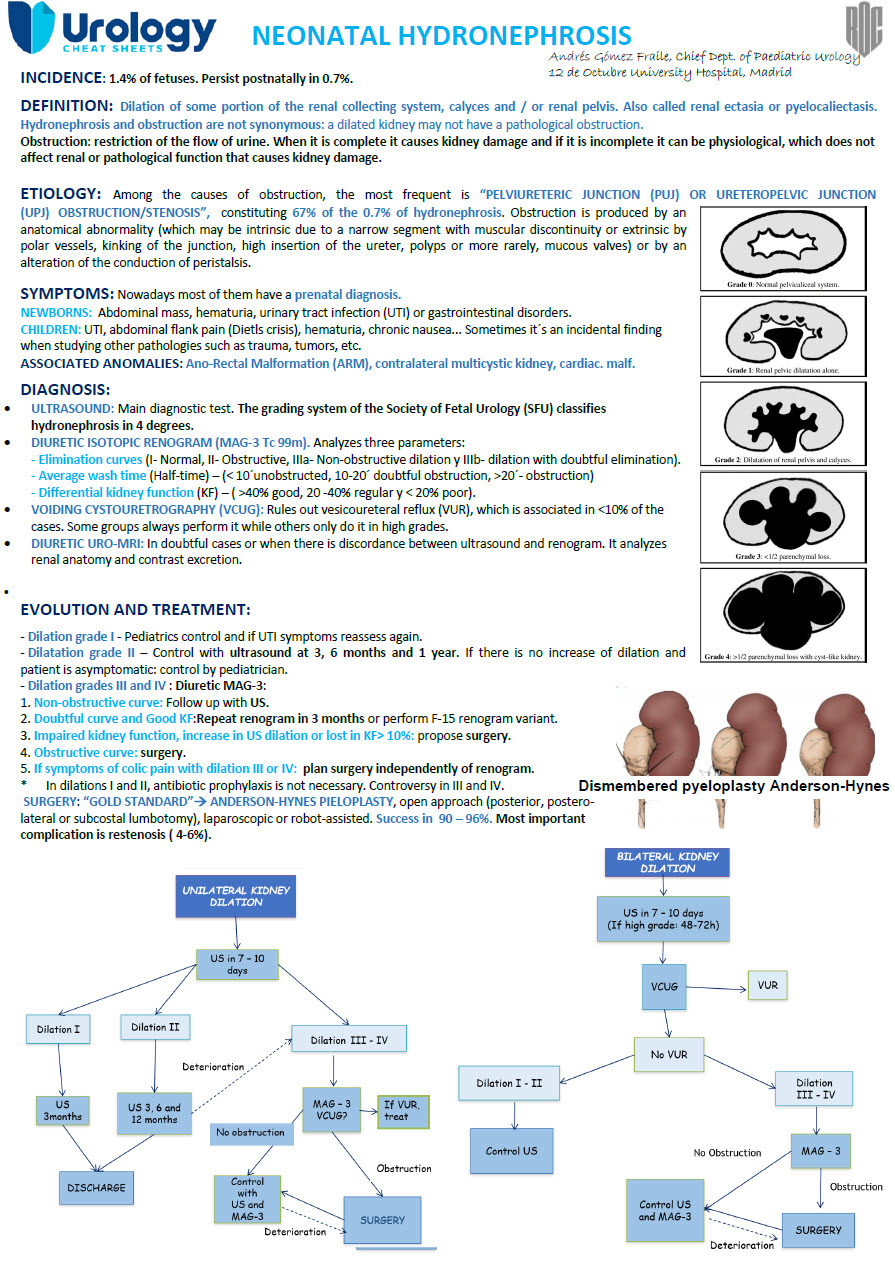 Neonatal Hydronephrosis By Andrés Gómez Fraile - Urology Cheatsheets